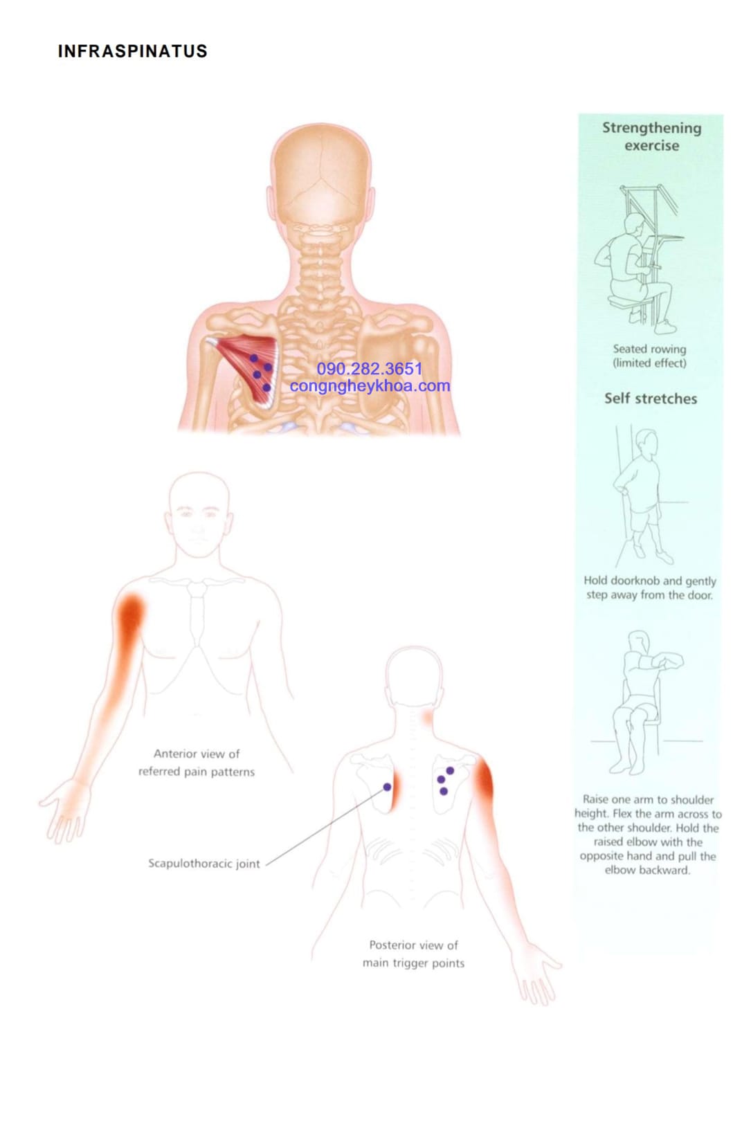 Trigger point là gì? - Công Nghệ Y Khoa MDT