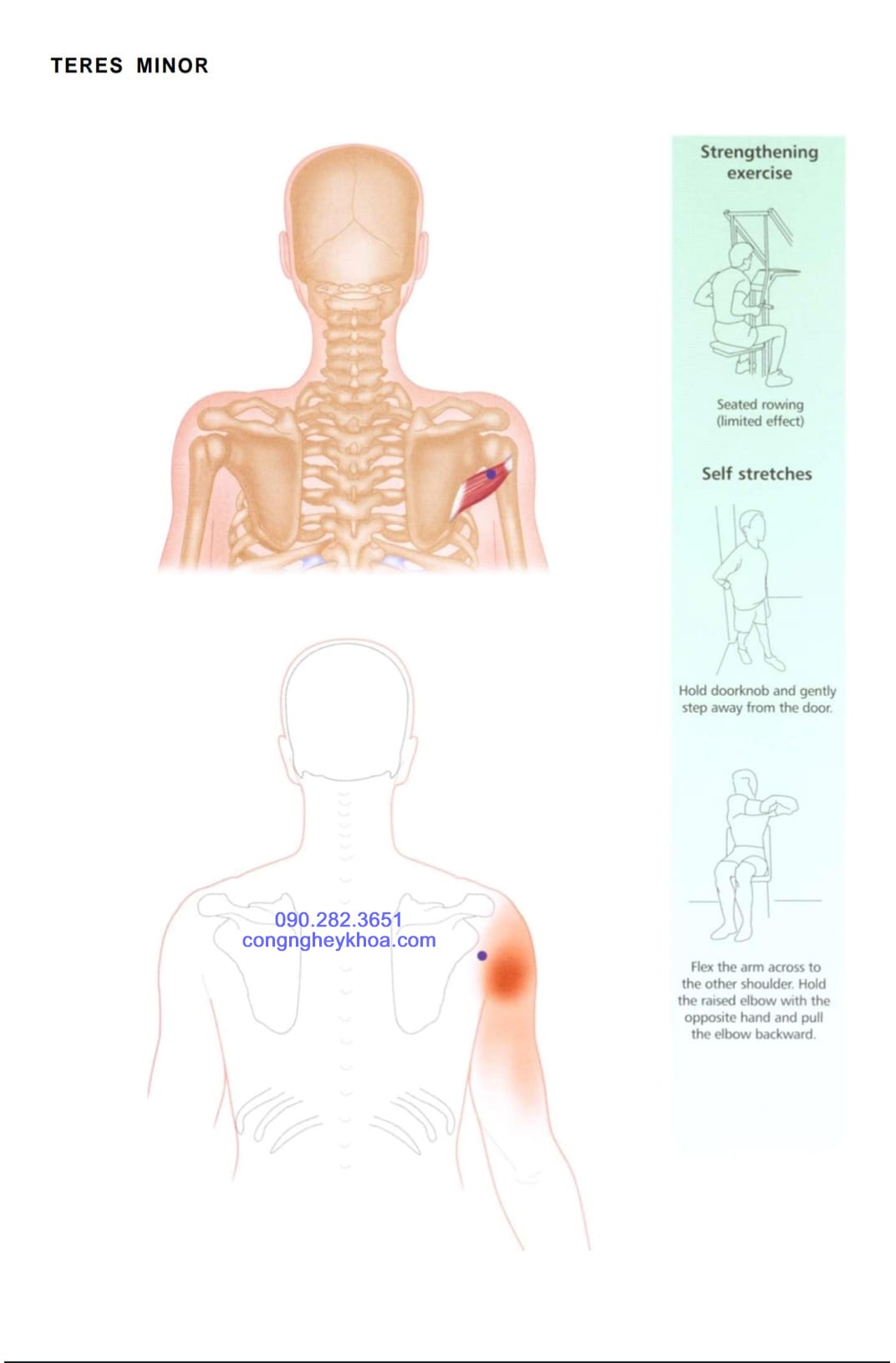 Trigger point là gì? - Công Nghệ Y Khoa MDT